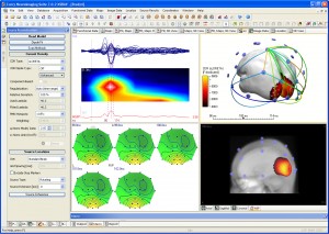 CURRY – Compumedics