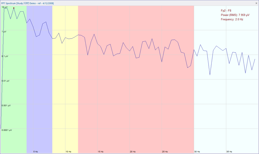 Profusion EEG Software – Compumedics