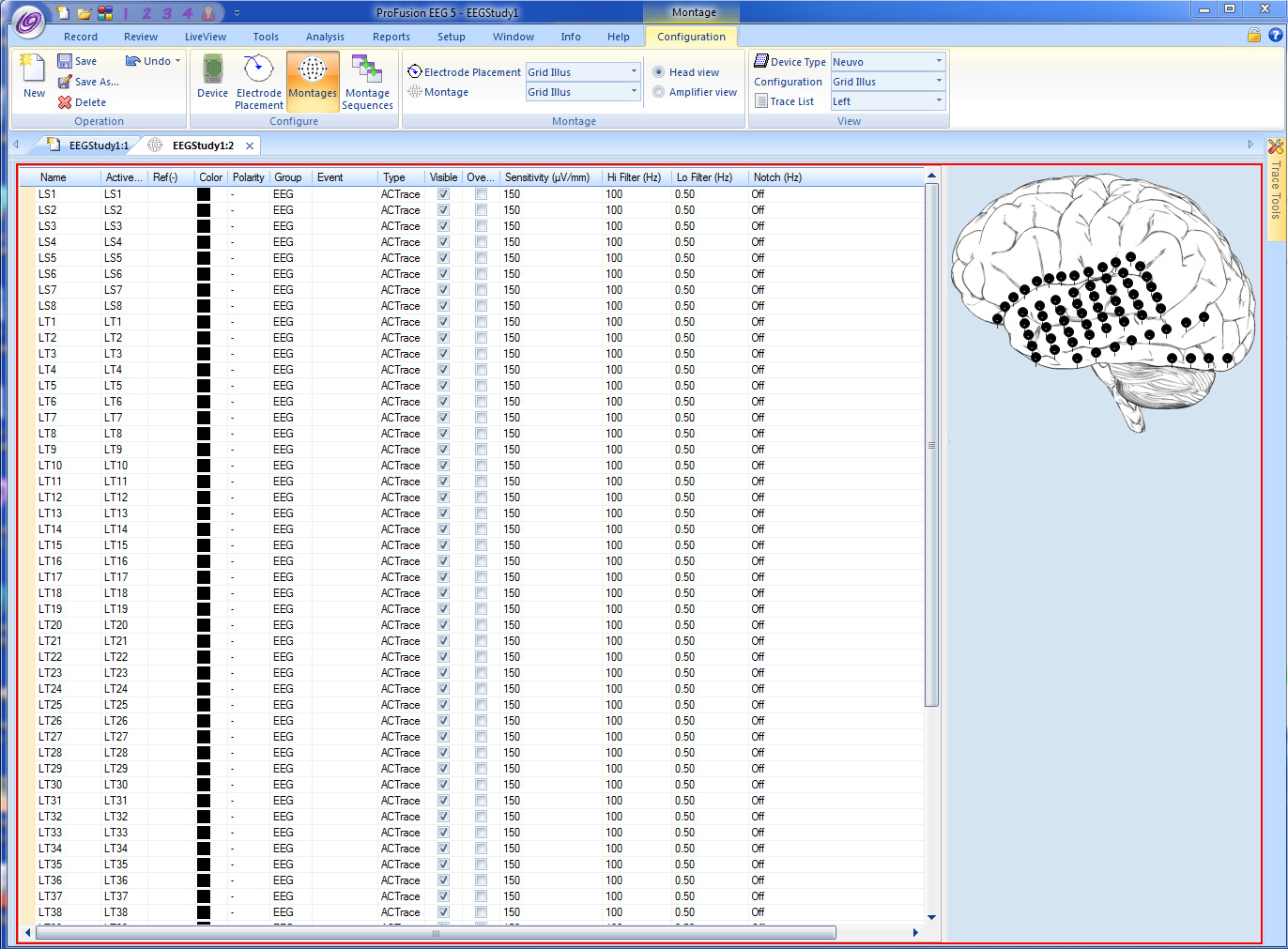 Profusion EEG Software – Compumedics