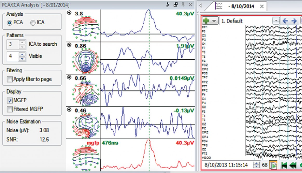 Profusion EEG Software – Compumedics