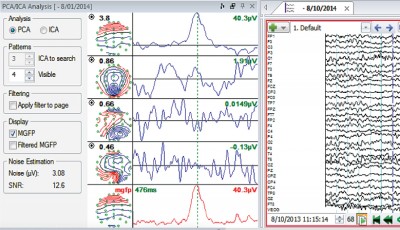 Profusion EEG Software – Compumedics