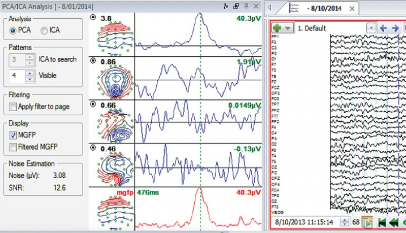 Profusion EEG Software – Compumedics