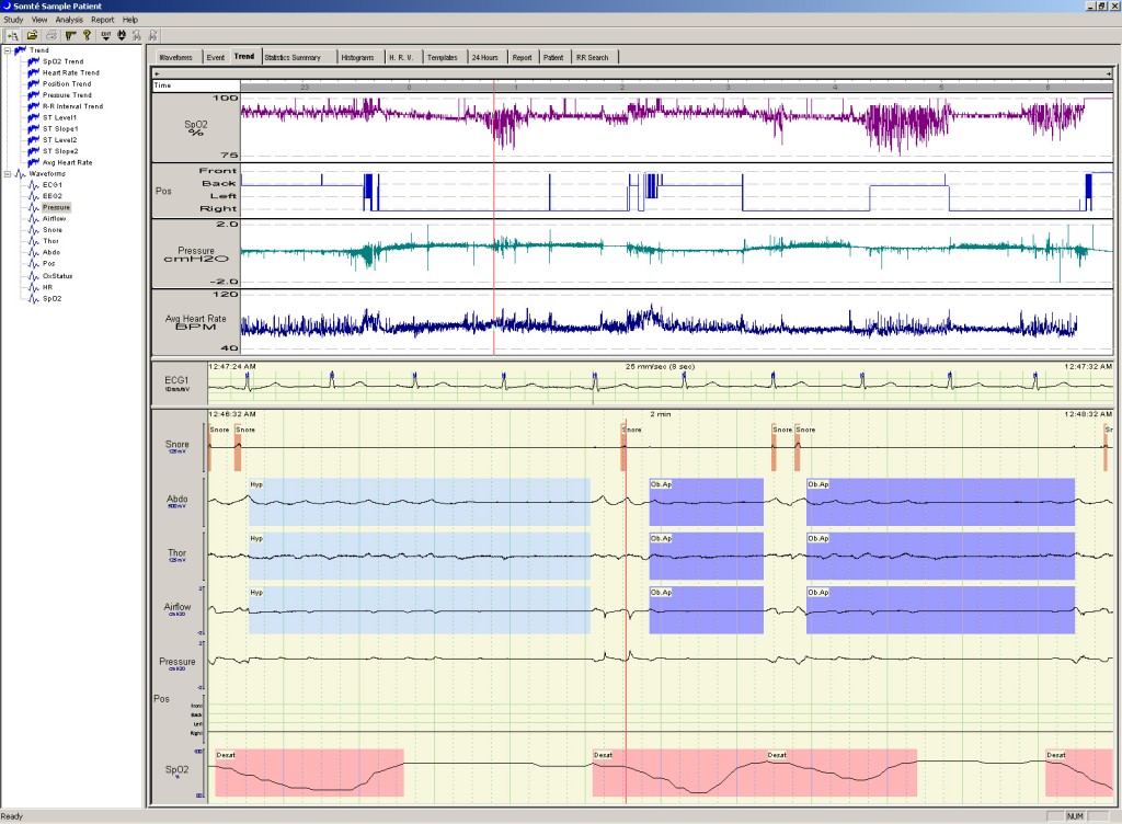 Somté Software – Compumedics