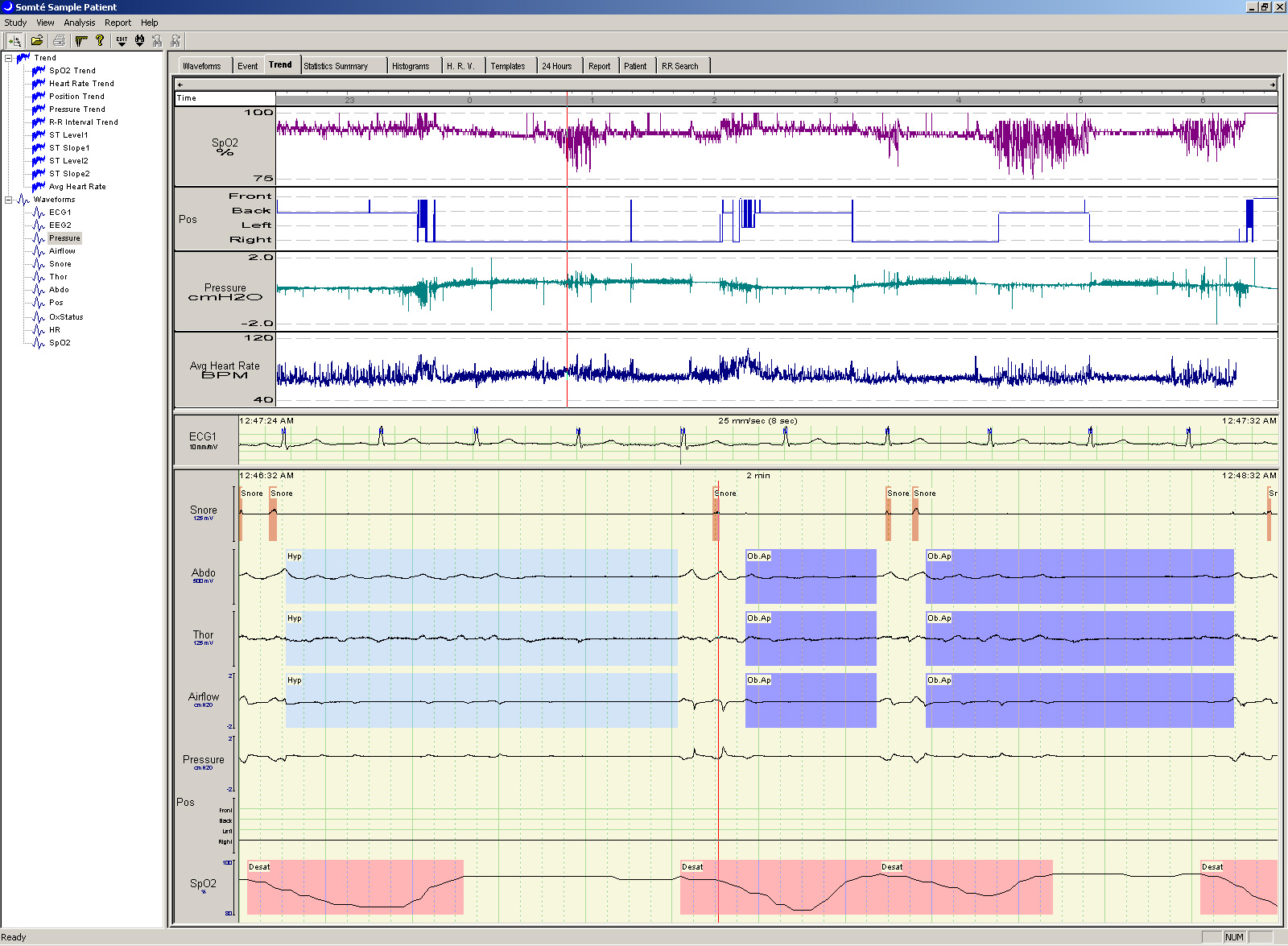 Somté Software – Compumedics