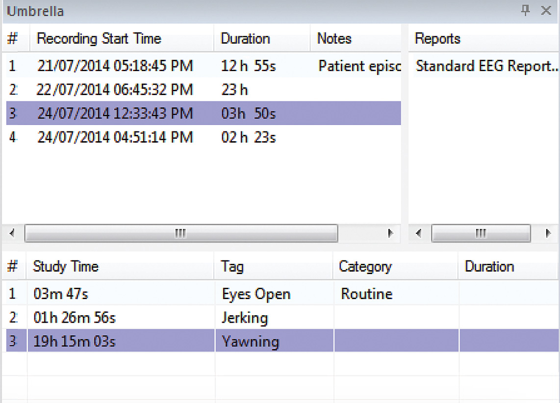 Logiciel Profusion EEG – Compumedics
