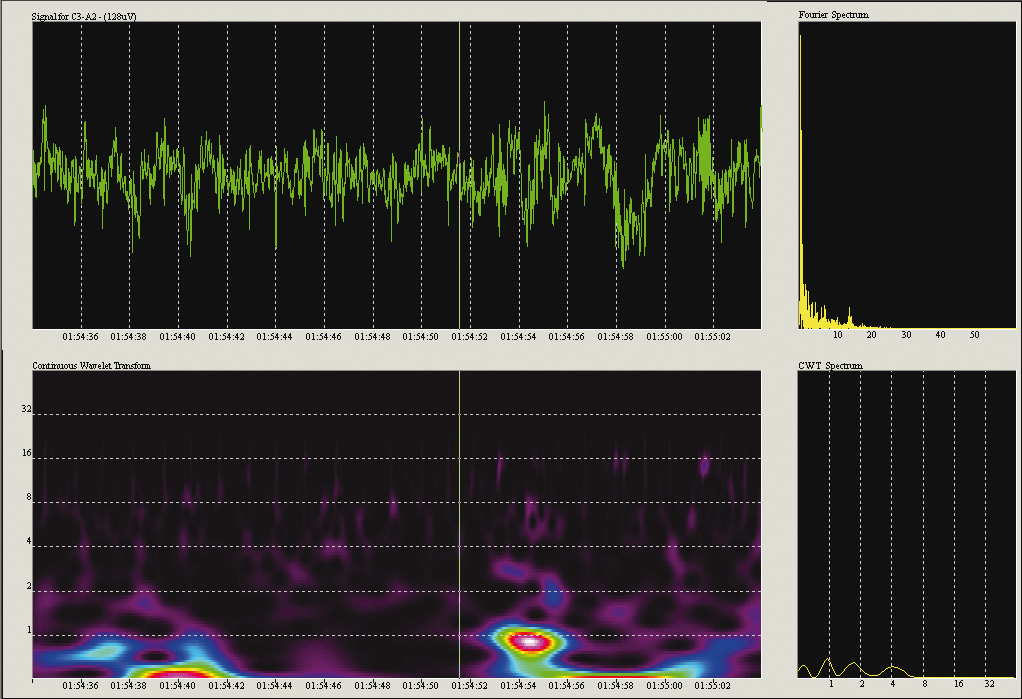 Profusion Plus – Compumedics