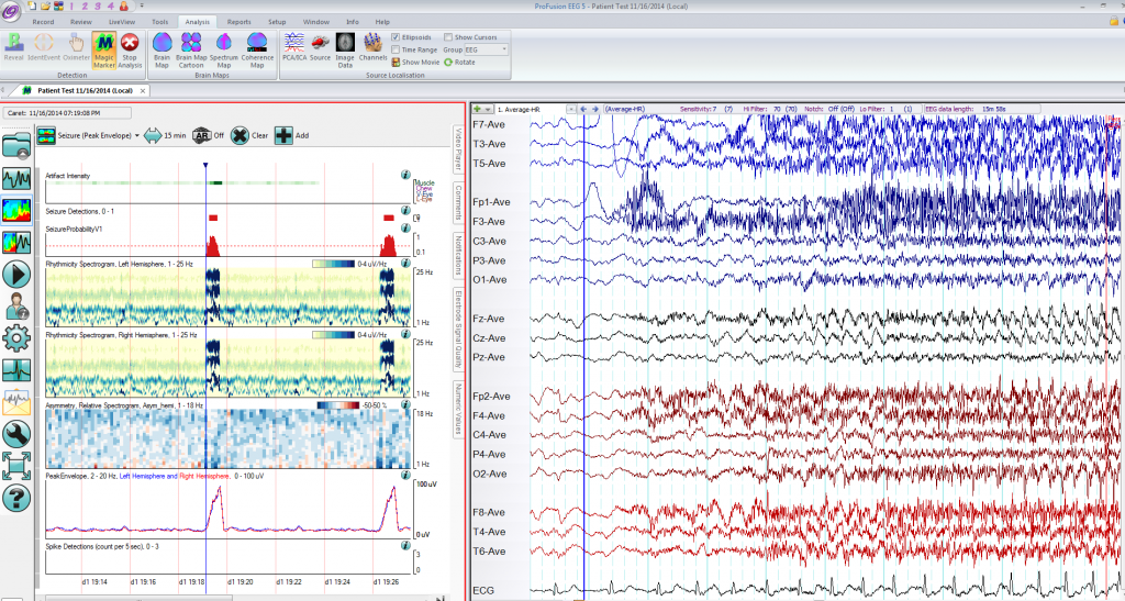 Persyst Software – Compumedics