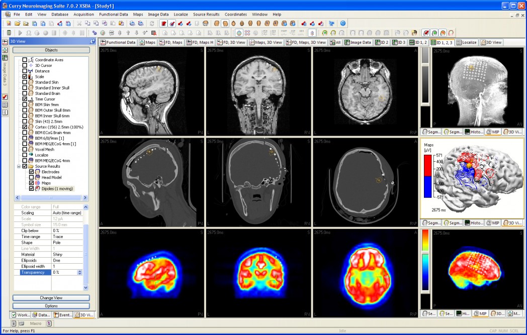 CURRY – Compumedics
