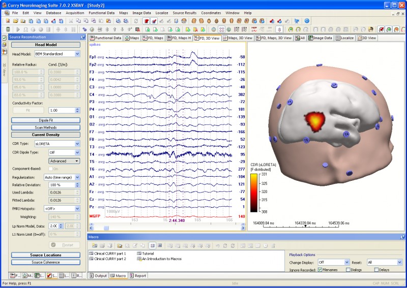 CURRY – Compumedics