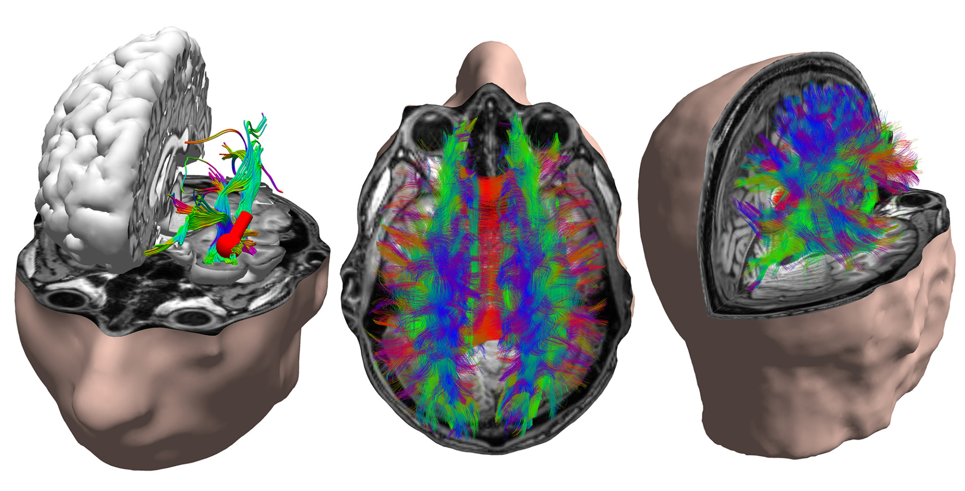 CURRY® – Compumedics