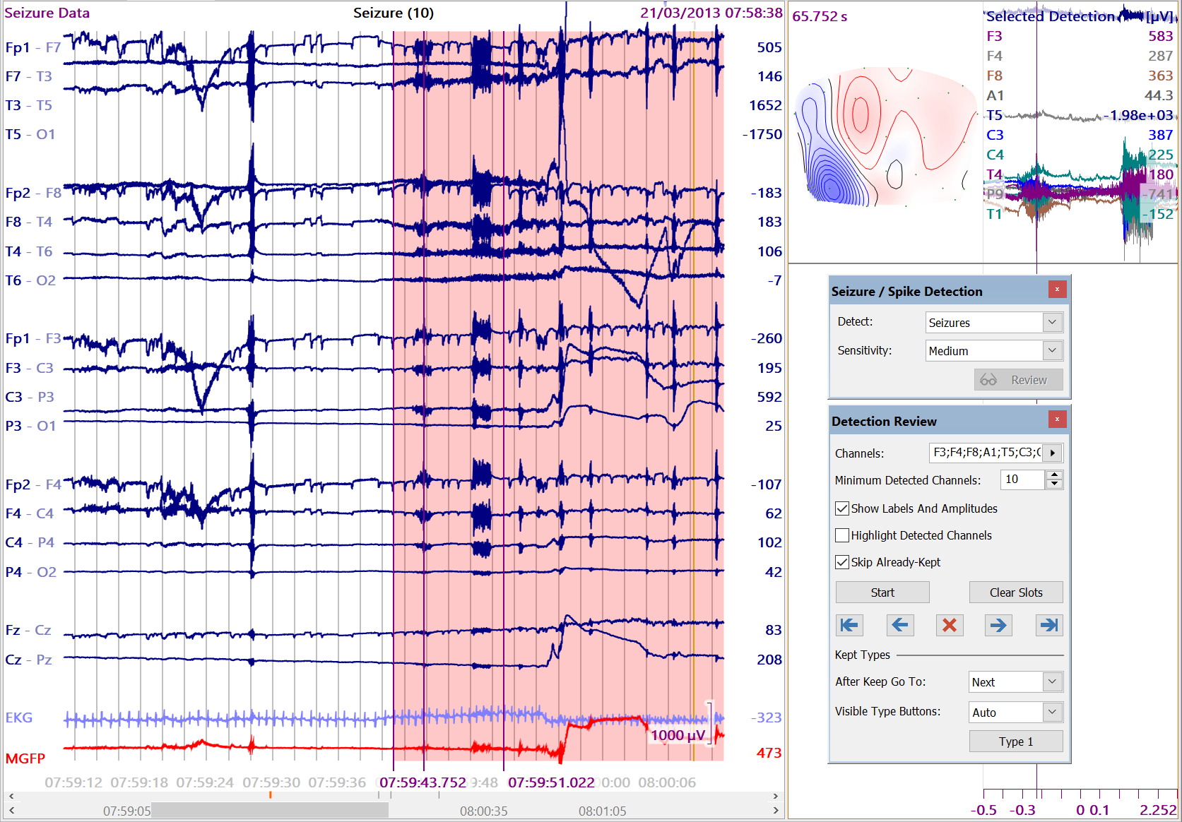CURRY® – Compumedics
