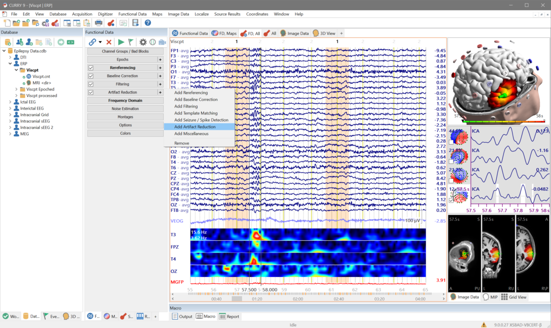 CURRY® – Compumedics