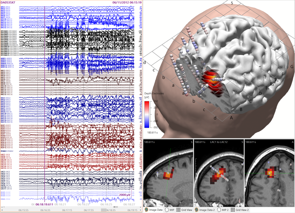 CURRY® – Compumedics