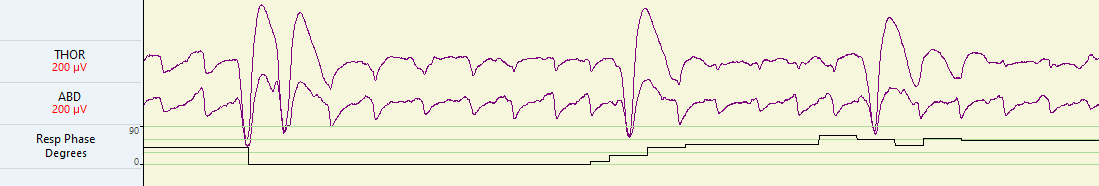 Profusion Sleep Software – Compumedics