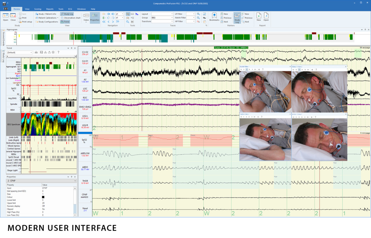 Profusion Sleep Software – Compumedics