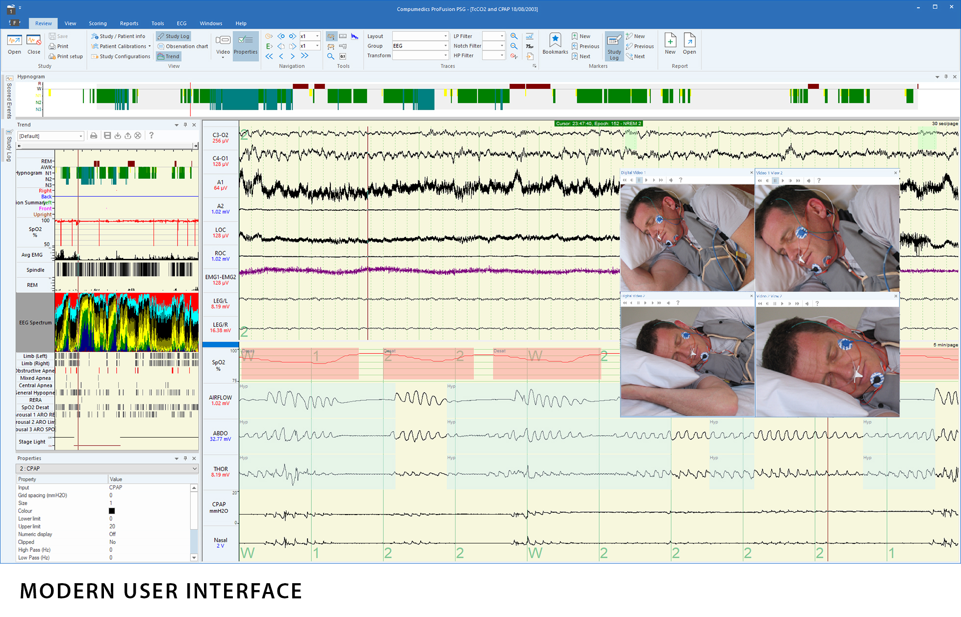 Profusion Sleep Software – Compumedics