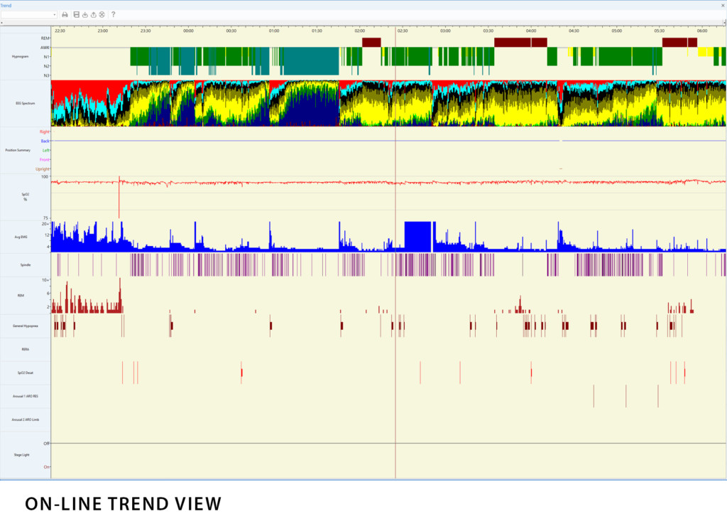 Profusion Sleep Software – Compumedics
