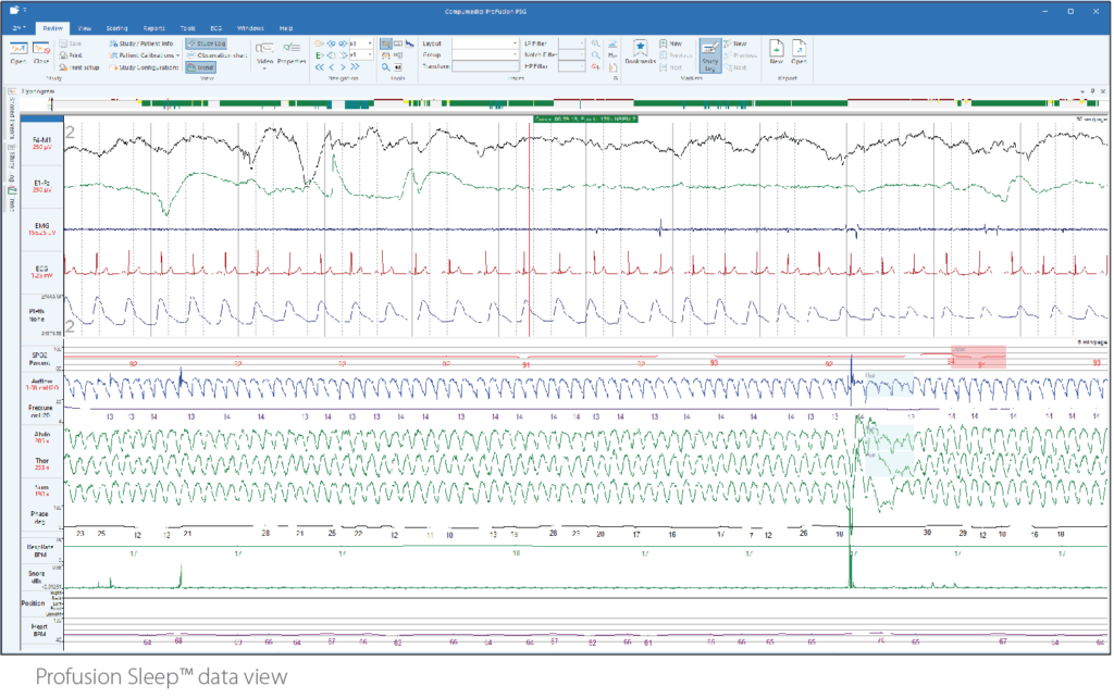 Falcon™ HST – Compumedics